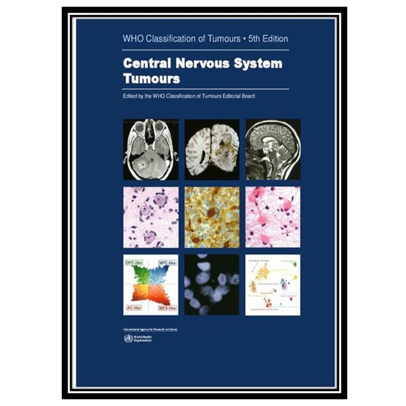 قیمت و خرید کتاب WHO Classification of Tumours - Central Nervous System Tumours, 5th Edition اثر ...