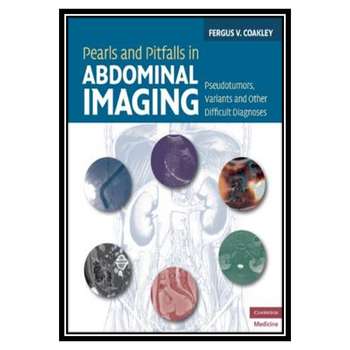 قیمت و خرید کتاب Pearls And Pitfalls In Abdominal Imaging Pseudotumors