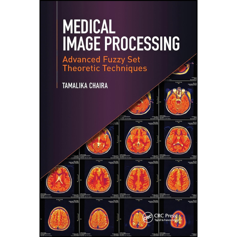 قیمت و خرید کتاب Medical Image Processing اثر Tamalika Chaira انتشارات تازه ها