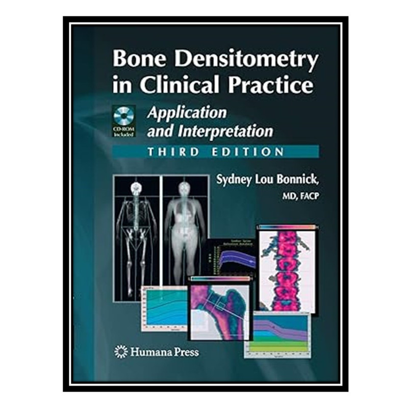 قیمت و خرید کتاب Bone Densitometry in Clinical Practice: Application ...